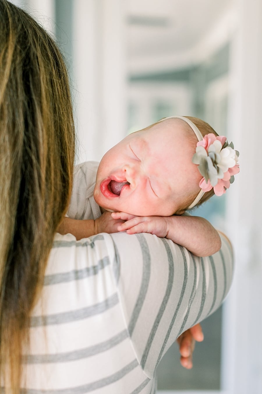 Cleft Baby Photo Shoot